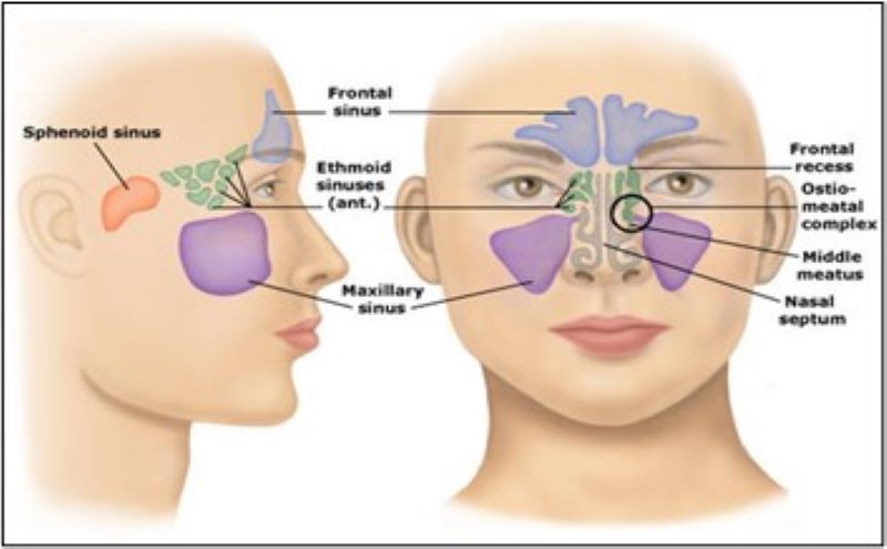 It’s Not Just the Sniffles: Approach to Diagnosis and Management of Sinusitis in the Pediatric ...