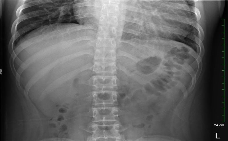 Pediatric Emergency Medicine // 2nd Place Emage Winner: Cardiomyopathy