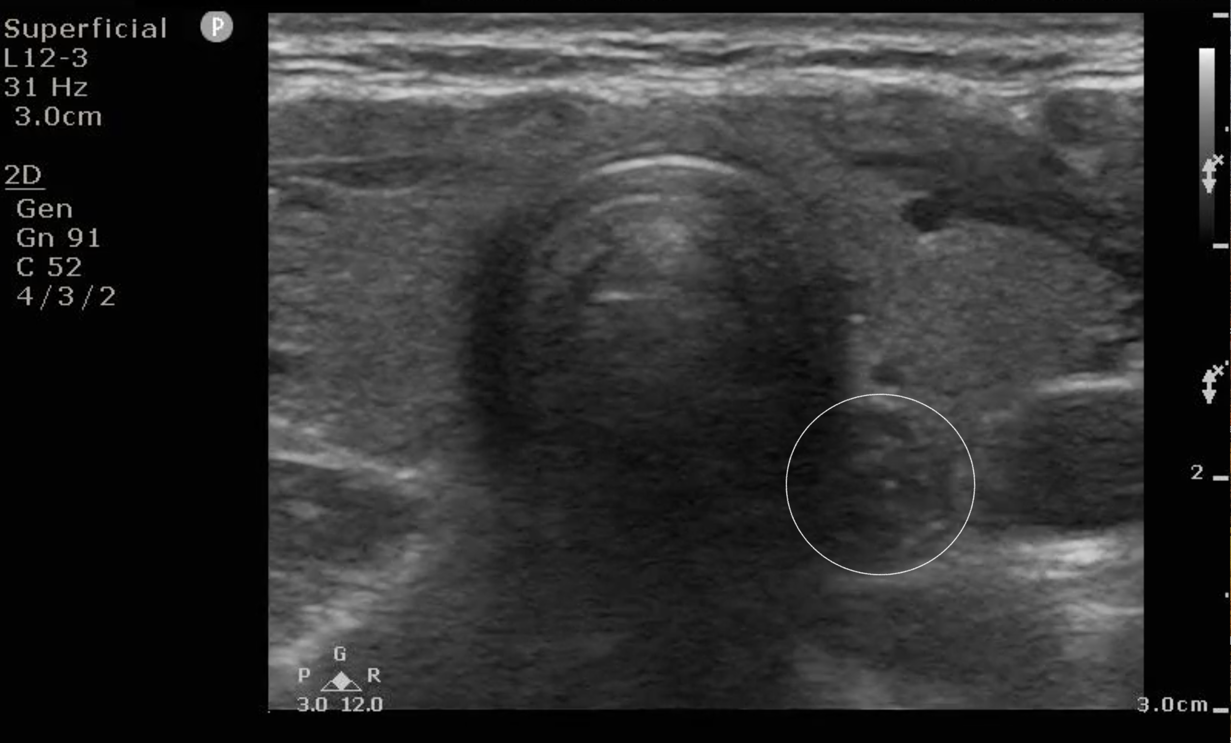 Sonoguide // Airway Emergencies