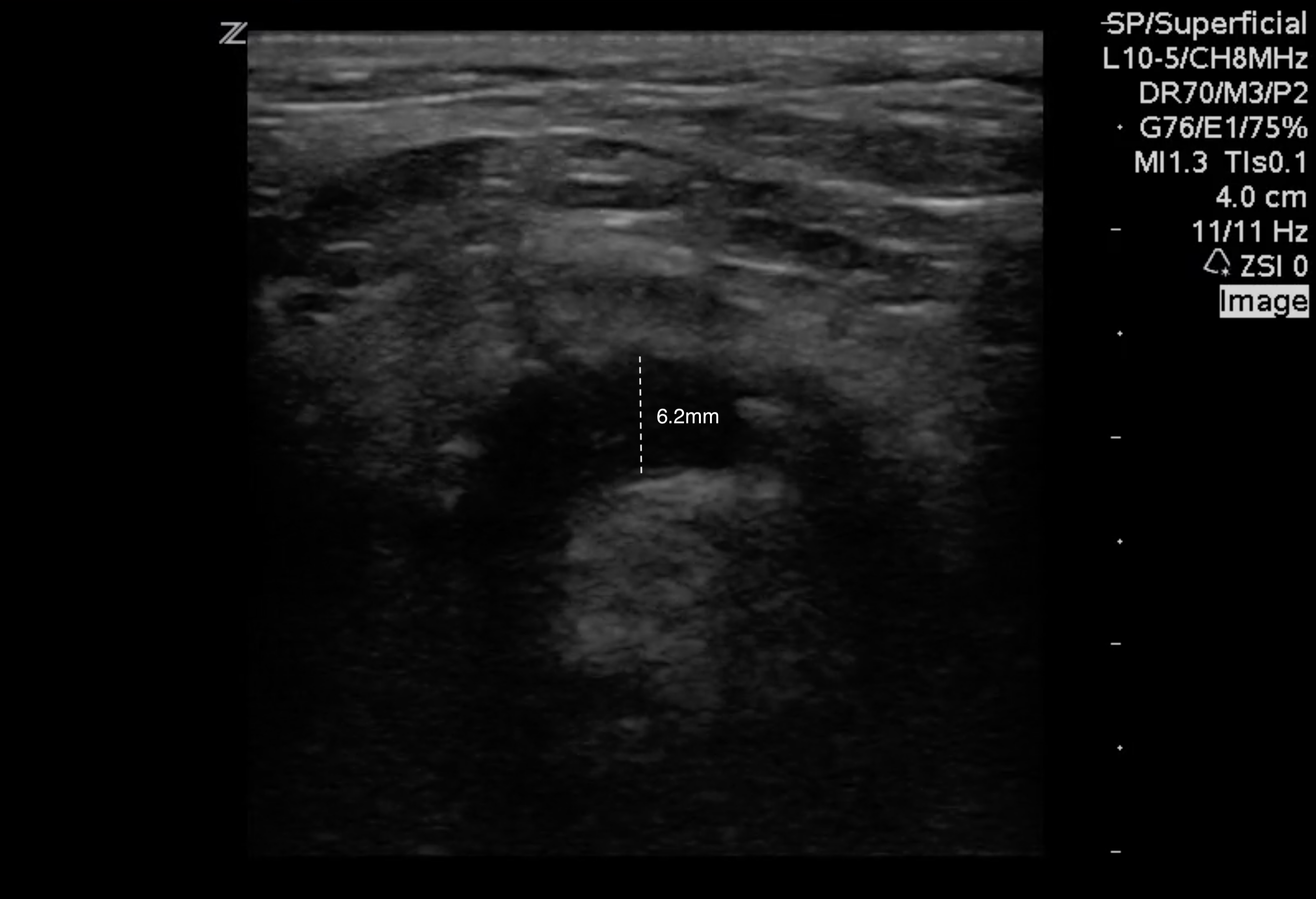 Sonoguide // Airway Emergencies