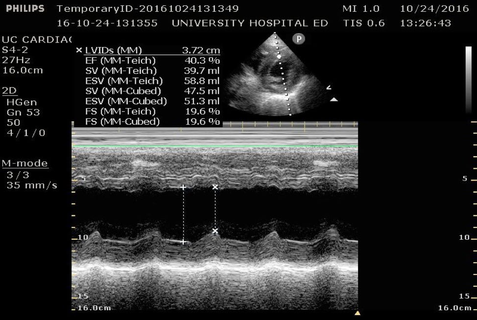 Sonoguide // Rapid Ultrasound for Shock and Hypotension (RUSH)