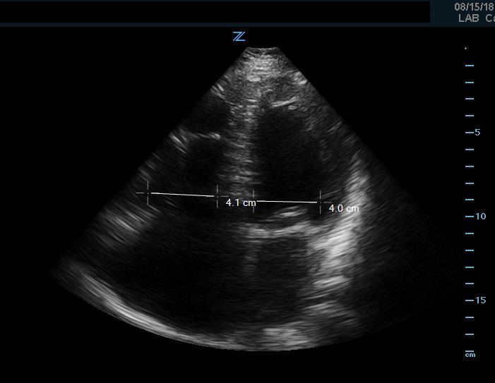 Sonoguide // Rapid Ultrasound for Shock and Hypotension (RUSH)