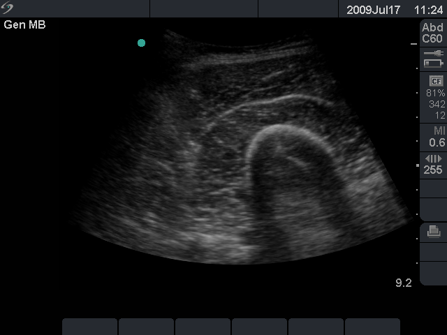 Sonoguide // Soft Tissue Ultrasound