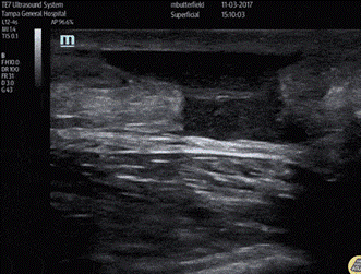 Sports Medicine Section // Re-evaluating Red Flags for Back Pain