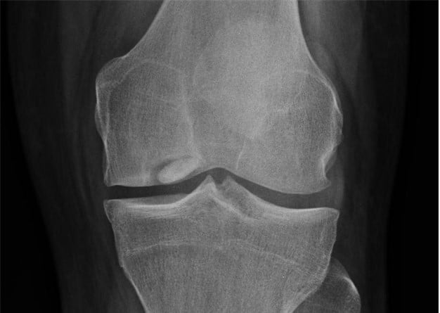 Sports Medicine Section // The Jammed Finger