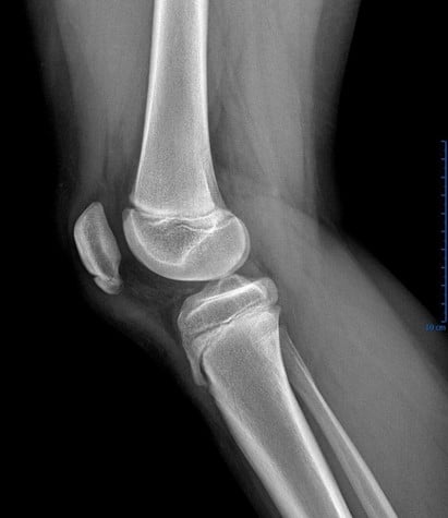 Sports Medicine Section // The Jammed Finger