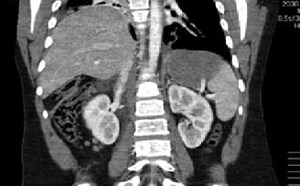 Sports Medicine Section // EMRA Splinting Guide