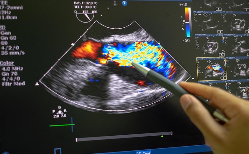 EM Ultrasound Section // Six Steps to Mastering your Echocardiography ...