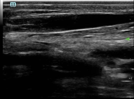 EM Ultrasound Section // Tips and Tricks: Best Practices for Ultrasound ...