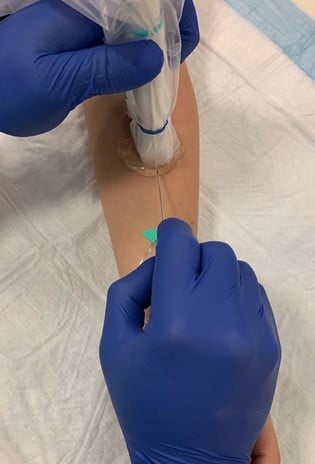 EM Ultrasound Section // Tips and Tricks: Best Practices for Ultrasound ...