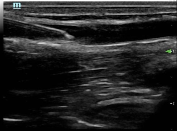 EM Ultrasound Section // Tips and Tricks: Best Practices for Ultrasound ...
