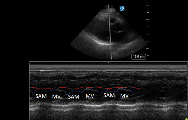 EM Ultrasound Section // Cases That Count: Whirlpool Sign in Testicular ...