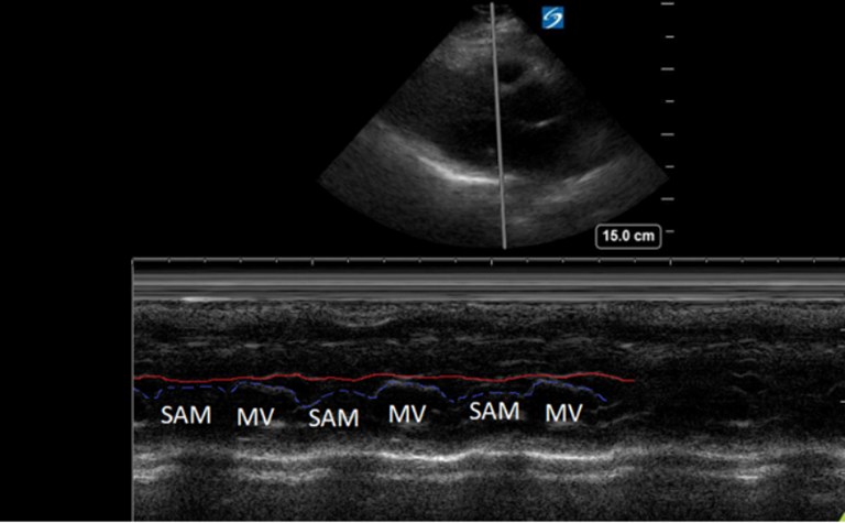 EM Ultrasound Section // Cases That Count: Whirlpool Sign in Testicular ...