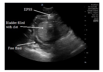 EM Ultrasound Section // Cases that Count: Serial FAST examinations in ...