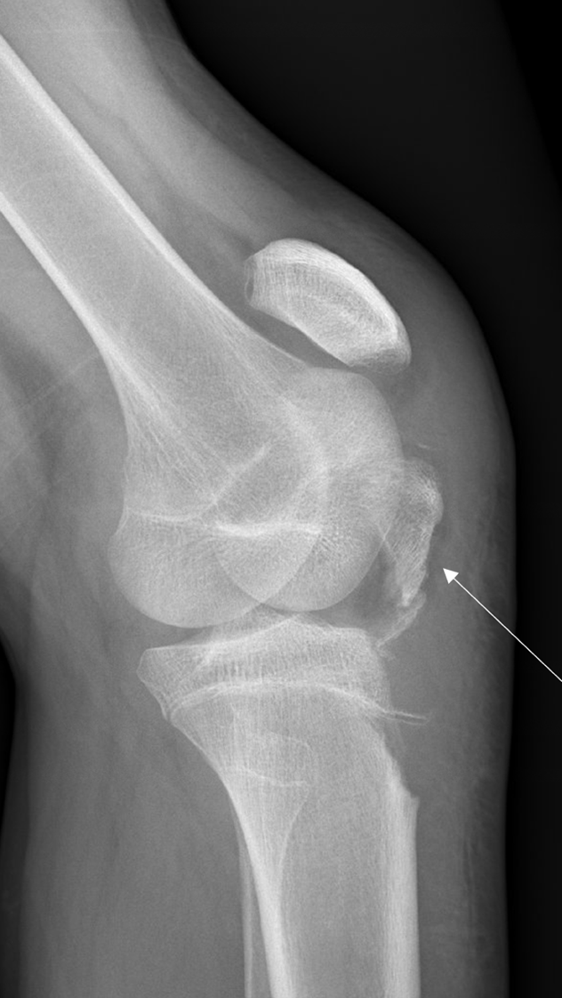 EM Ultrasound Section // Cardiac Tamponade and Ultrasound-Guided ...