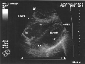 EM Ultrasound Section // Ultrasound Anatomy