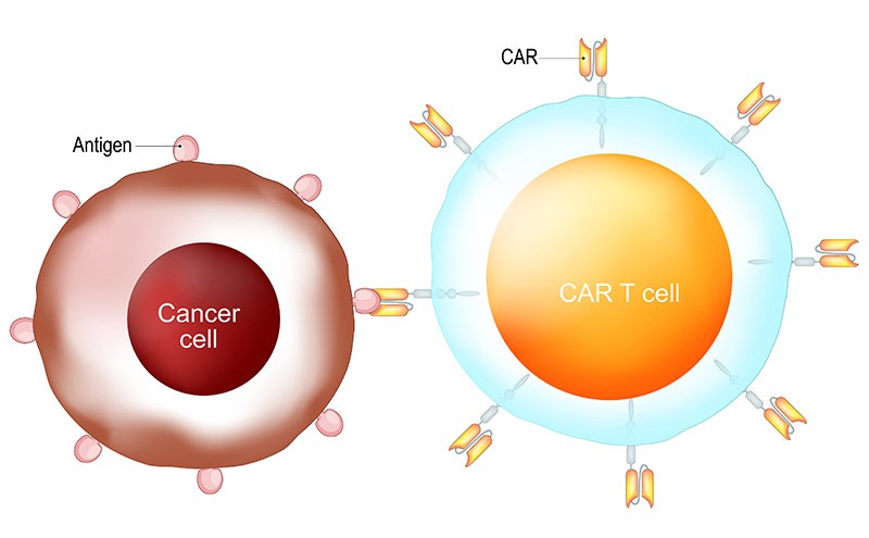 CAR-T Therapy and the Cytokine Storm | Critical Care Medicine Section