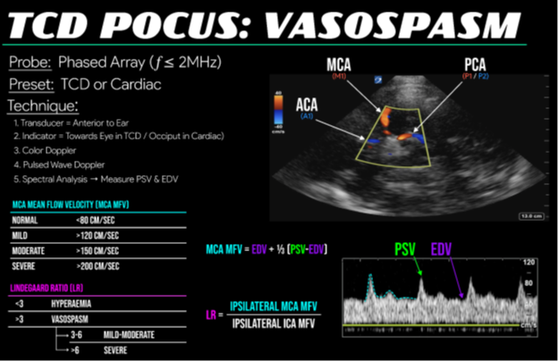 Transcranial Doppler in the Emergency Department: A Clinical Application and Quick Reference ...