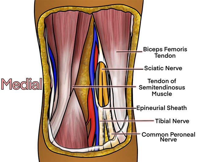 Popliteal Sciatic Nerve Block Sonoguide