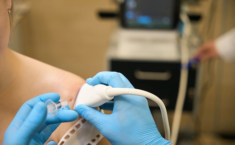 Pediatric Interscalene Nerve Block for Shoulder Dislocation and ...