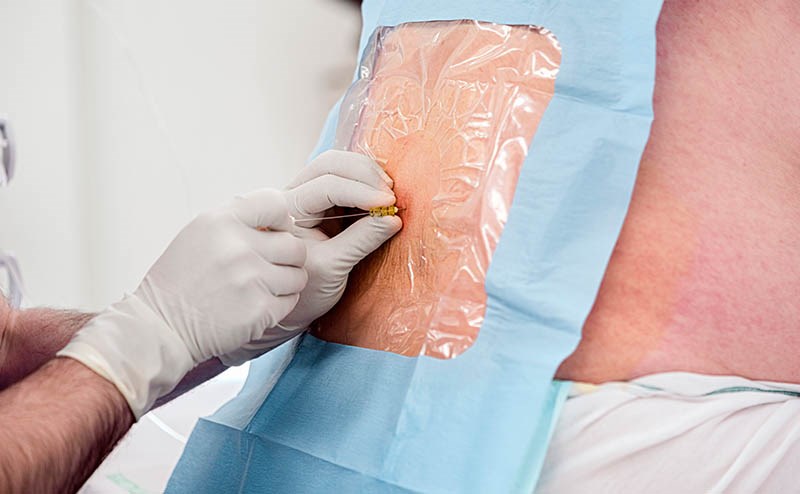 The Case for Identifying and Situationally Anesthetizing the Radial ...