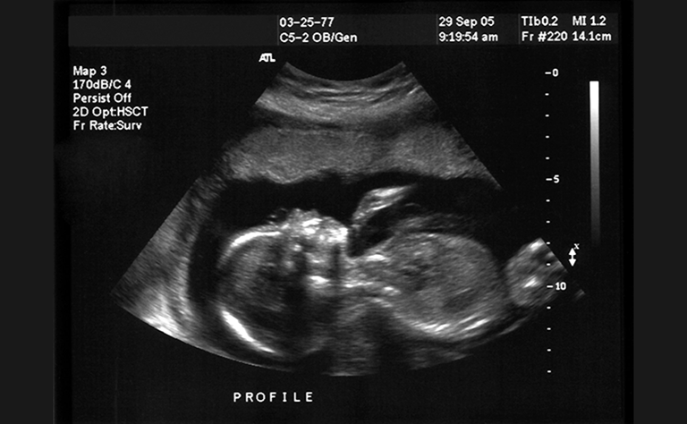 Literature Canon Update from the ACEP Emergency Ultrasound Fellowship ...