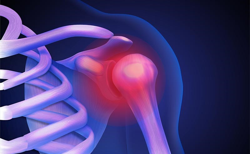 POCUS for Shoulder Pain in the Emergency Department | EM Ultrasound Section