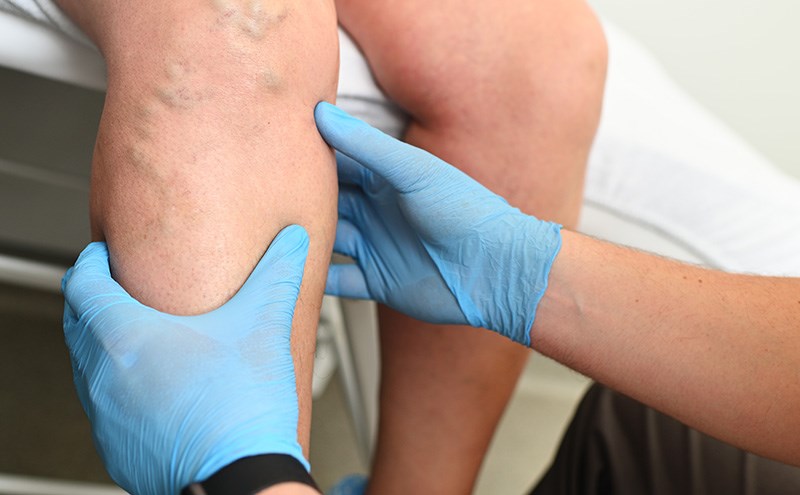 Deep Vein Thrombosis | EM Ultrasound Section